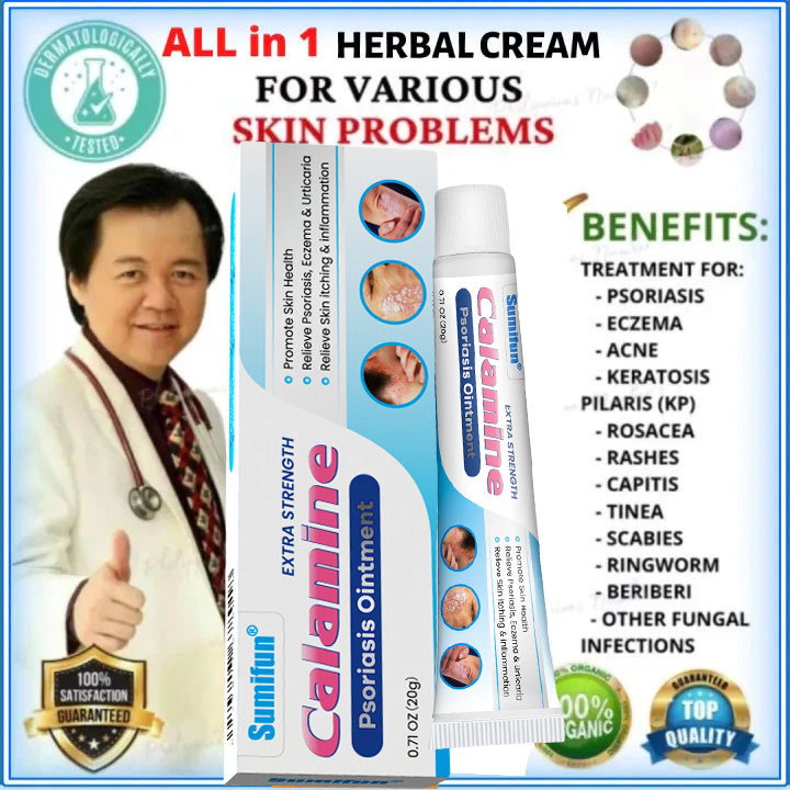Calamine Eczema Cream For Treating Psoriasis And ointment for skin ...