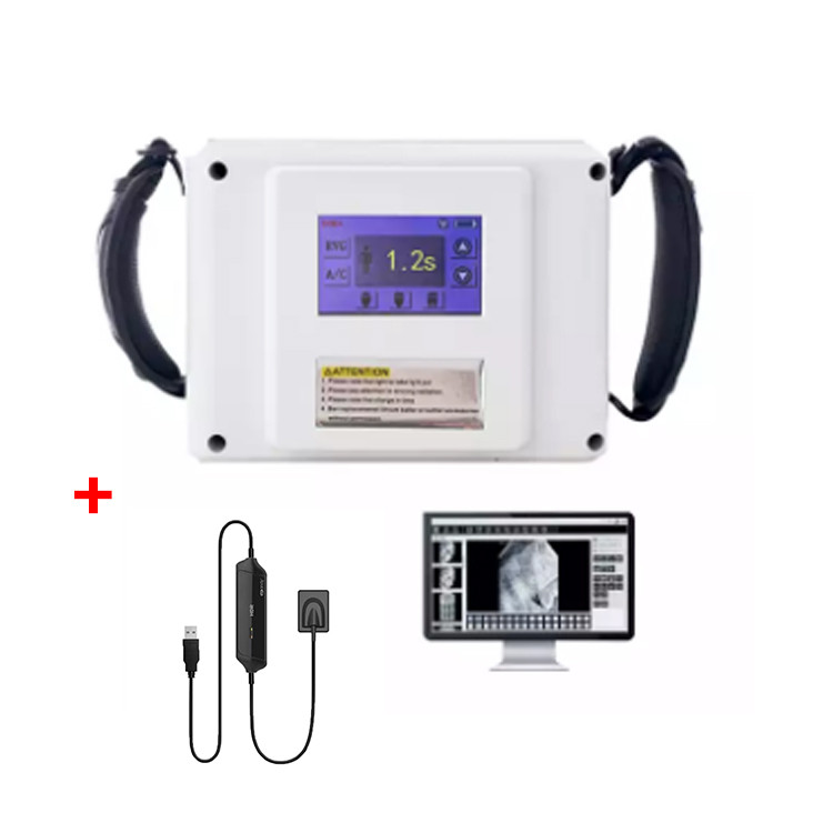 X-Ray Digital Portable X Ray Rvg Sensor Machine System Rx Camera ...