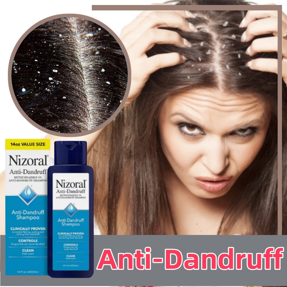 Anti-Dandruff Shampoo Deep Cleaning, Get Rid Of Dandruff, Anti-dandruff ...
