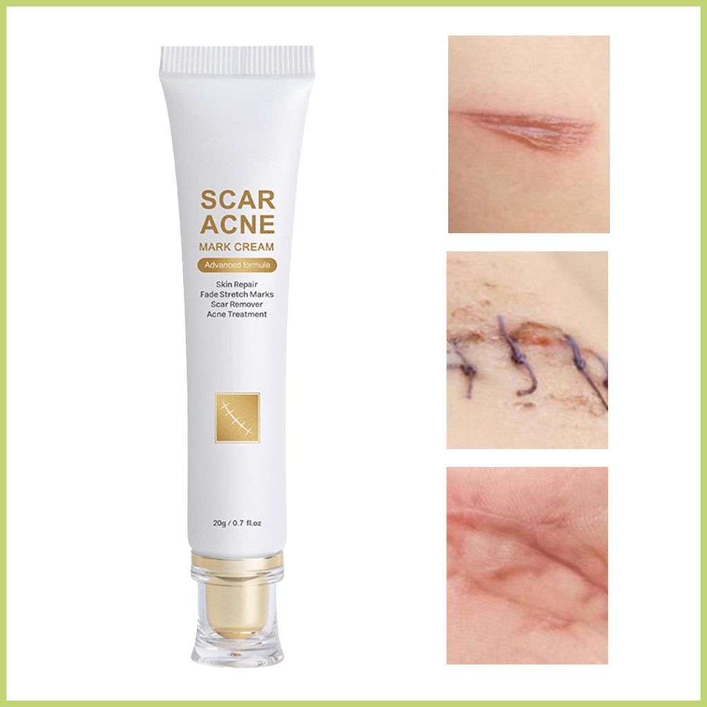 Scar Cream Fast Absorb Scar Cream Scar Cream Old and New Scars Repair ...