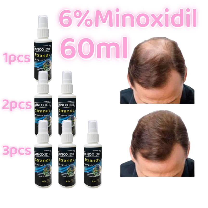 6% Topical Solution Hair Grower MINOXIDIL Beard Growth Original For Man ...