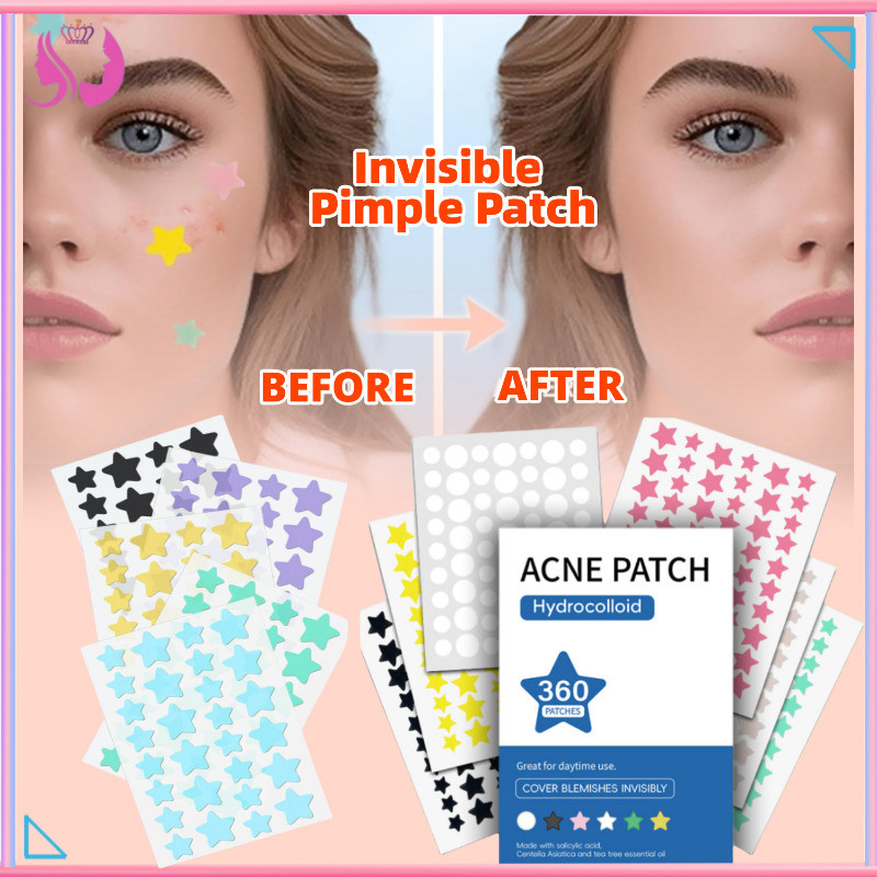 360PCS Star Pimple Patch Invisible Acne Removal Patch Skin Care ...