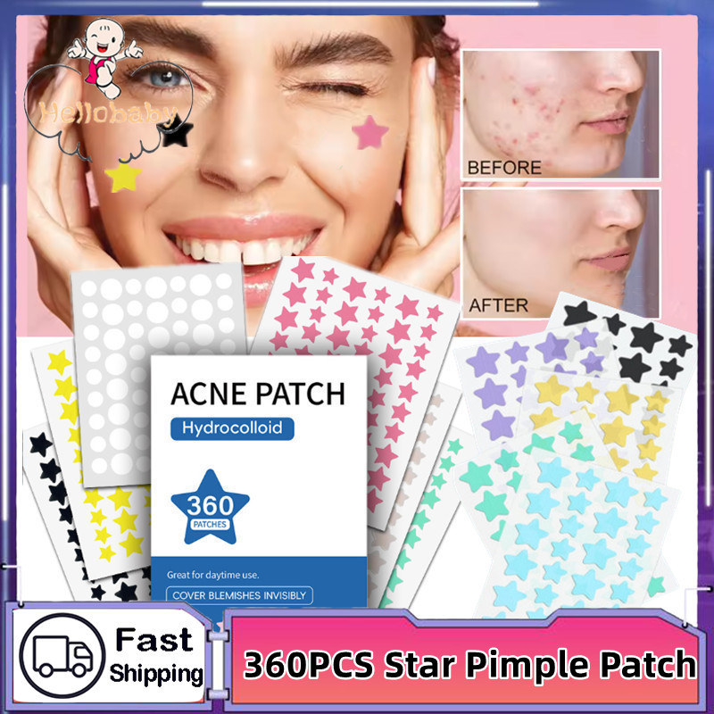 360PC Star Pimple Patch Acne Colorful Invisible Acne Removal Skin Care ...