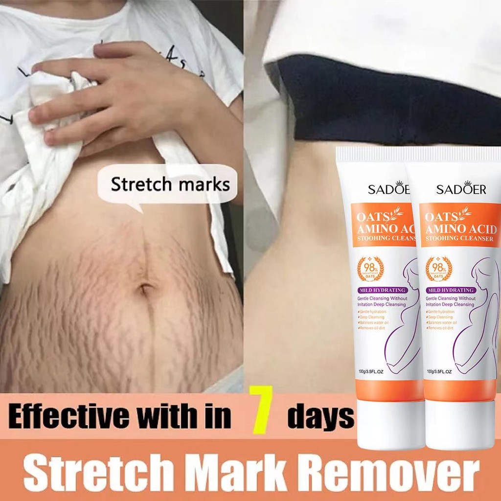 Stretch Mark Remover Cream Anti-Wrinkle Maternity Skin Repair Remove ...