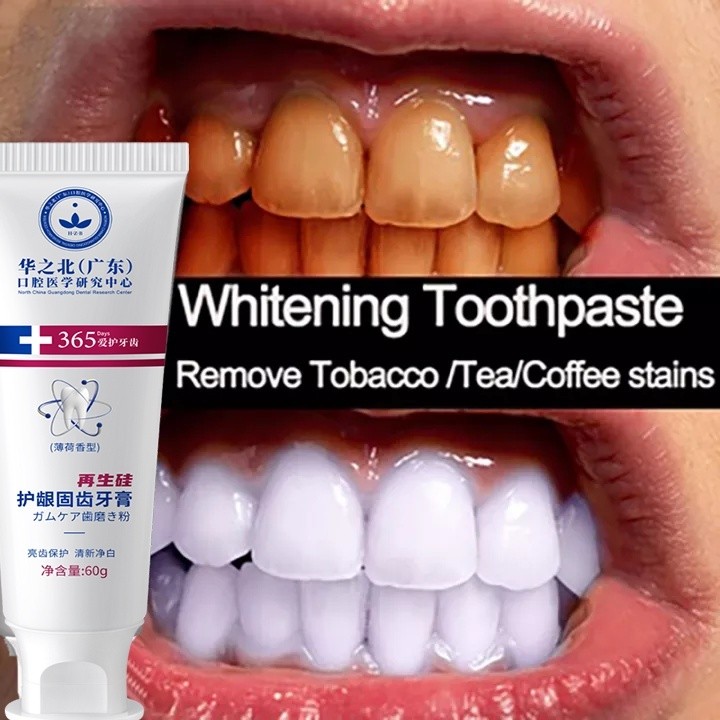 Probiotic Toothpaste Remove Yellow Bad Breath Whitening Calculus Teeth ...