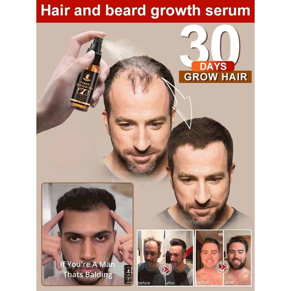 Gentle Treatment Spray Follicle Sideburns Beard Oil Hair Spray Gentle ...