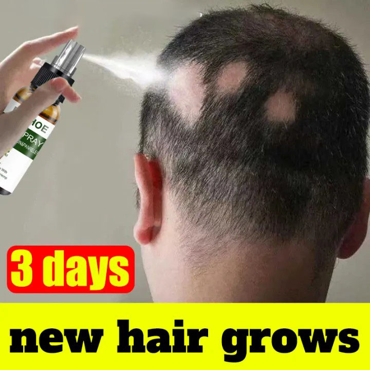 Anti Hair Loss Hair Grower Spray Ginger Novo Hair Growth Treatment ...