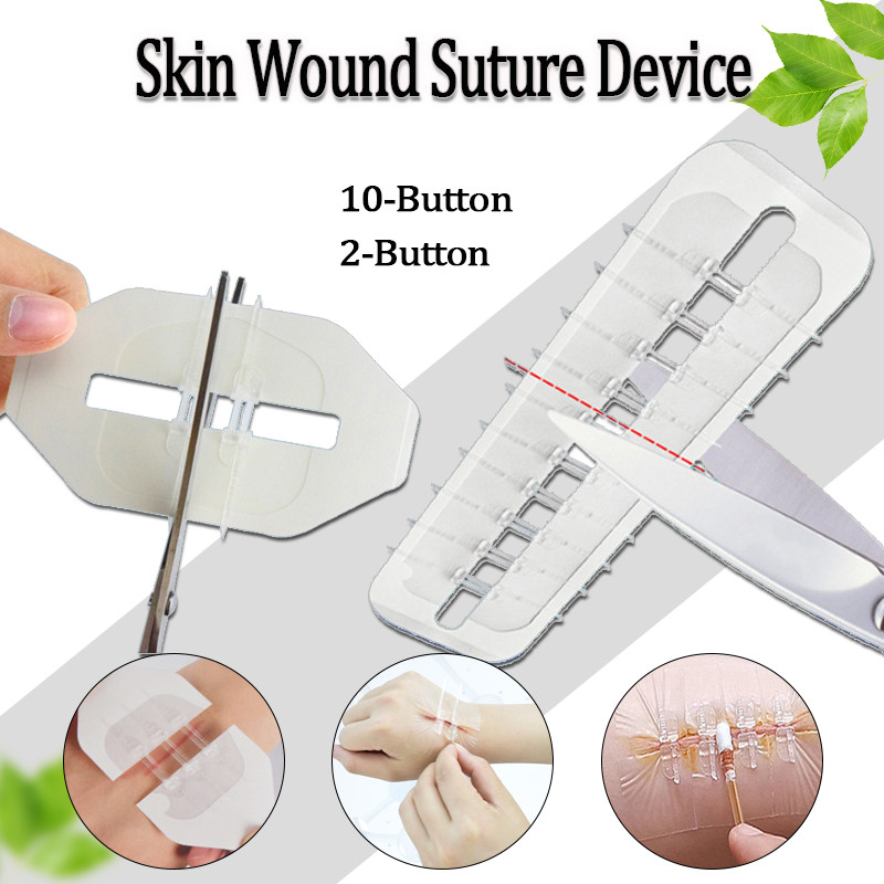 2/10-Button Medical Wound Closure Patch Wound Quick Suture Zipper Band ...