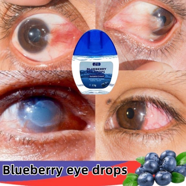 Blueberry eye drops original clear eye sight drops Treatment cataract ...