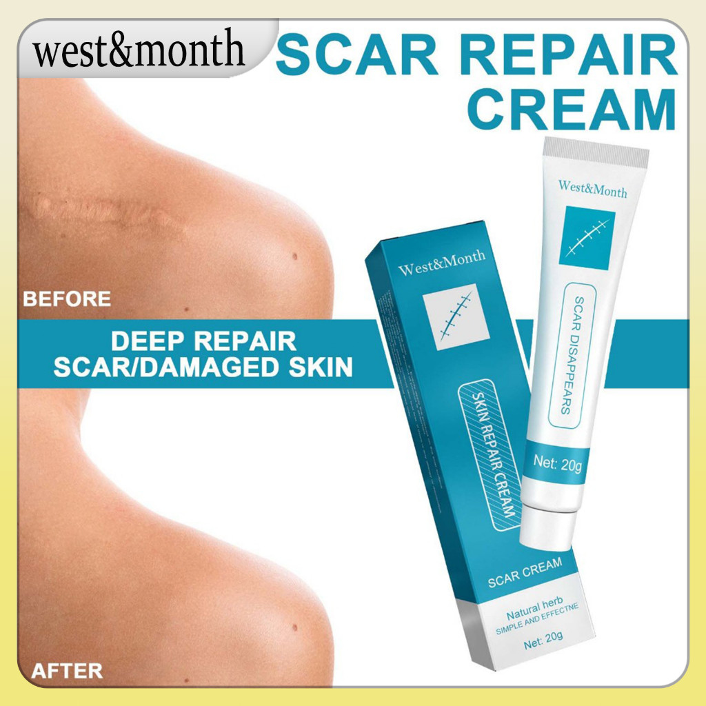 West&Month Cream Repair for hypertrophic scars 20g | Shopee Philippines