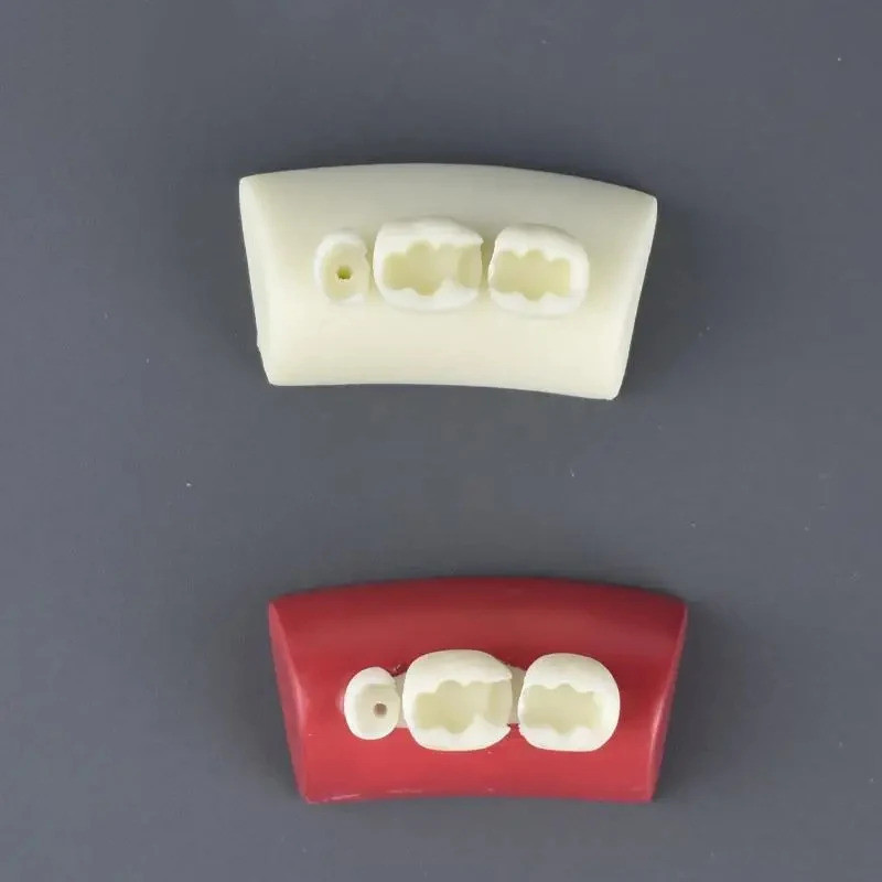 1PCS Oral Filling Model Dental Inlay Exercise Model Block Filling ...