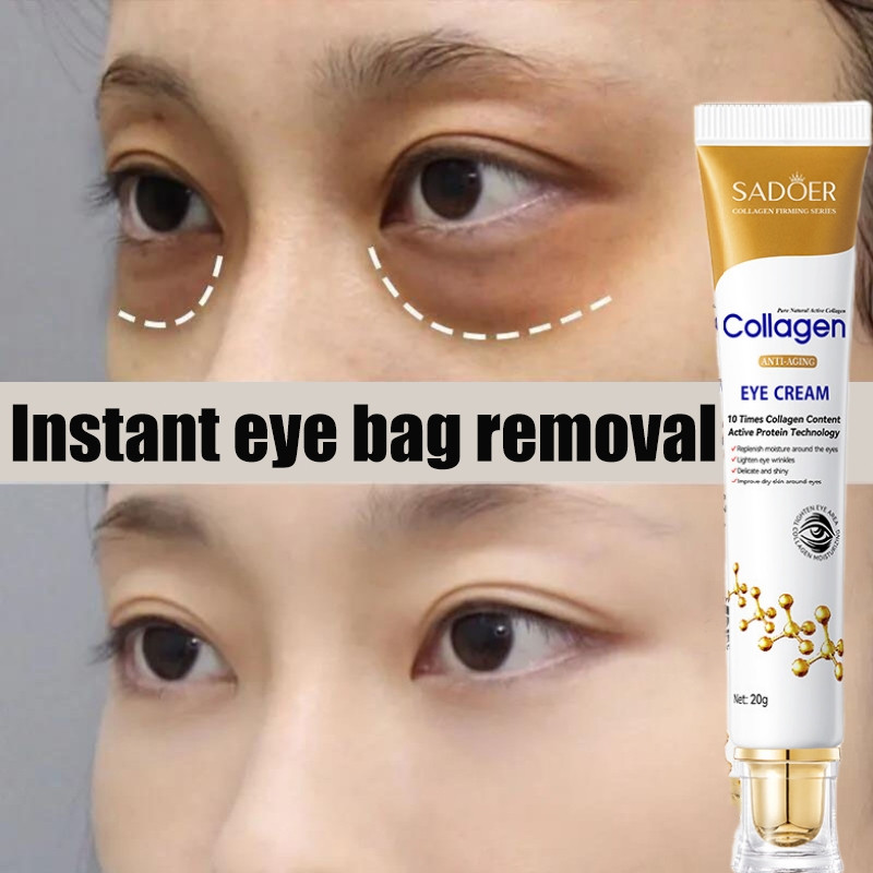 Collagen Eye Cream Eye Bag Remover Wrinkle Dark Circle Anti Puffiness ...