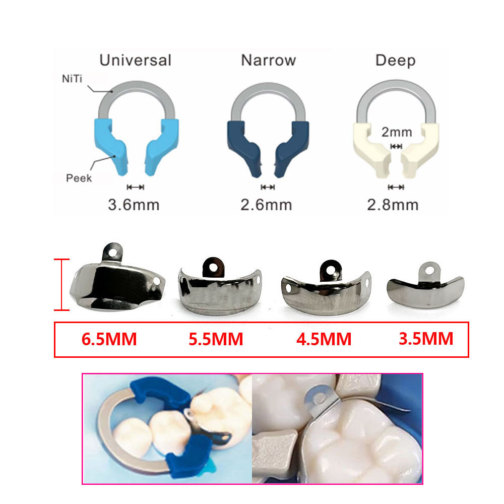 High Quality Dental Matrix Bands Sectional Contoured Matrix System ...