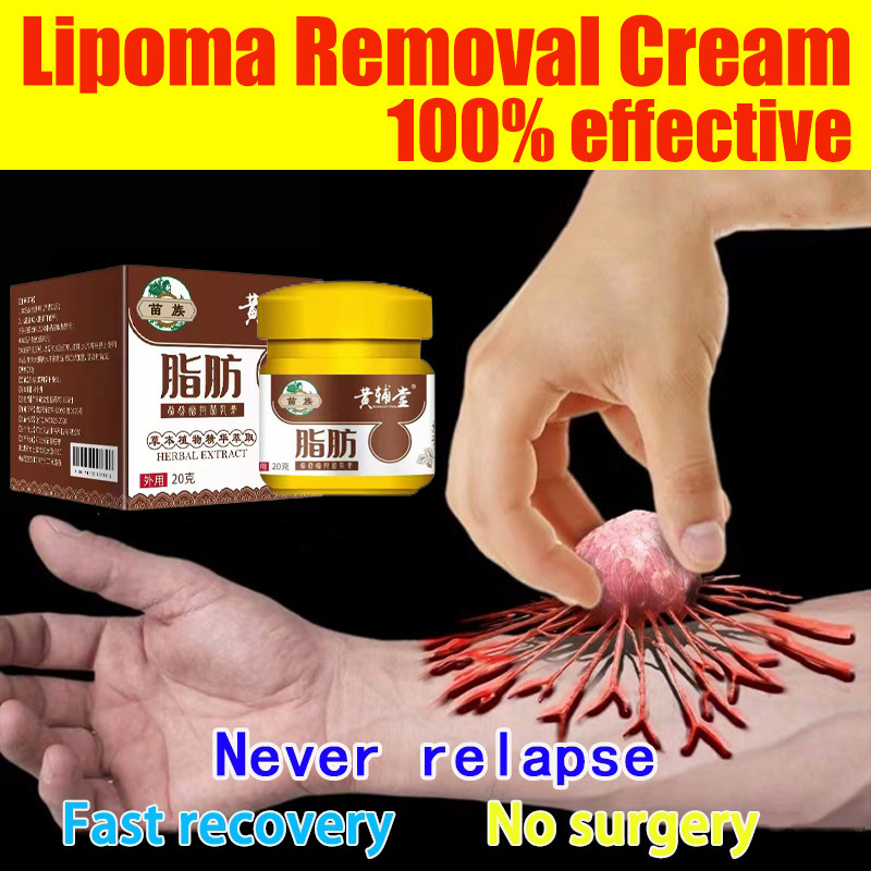 Lipoma Cream lump medicine lump Removal Cream Fatty Cellulite Cream ...
