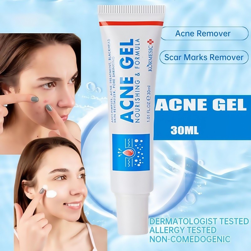 Pimple remover cream acne marks remover cream skin care products anti ...