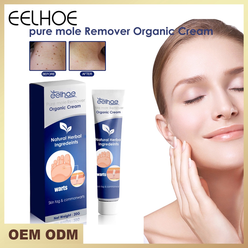 Hot Sale#EELHOE Wart Cream Fade Skin Moles Black Mole Corns Repair ...