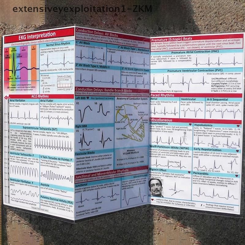 【EPPH】 EKG Pocket Guide, EKG Rhythm Interpretation, Double Sided Compact Portable Reference Card ...