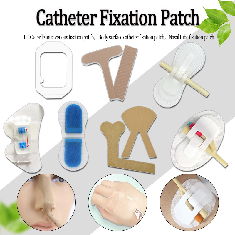 PICC Catheter Placement Patch Venous Body Surface Catheter Nasal Tube ...
