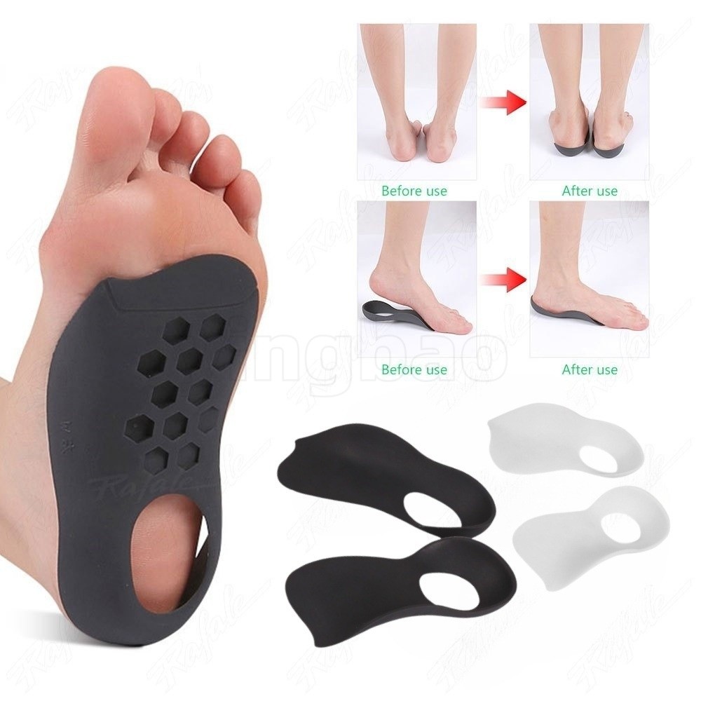 2 Pairs Flat Foot O-shaped Leg Insoles, Fasciitis Orthopedic Insole ...
