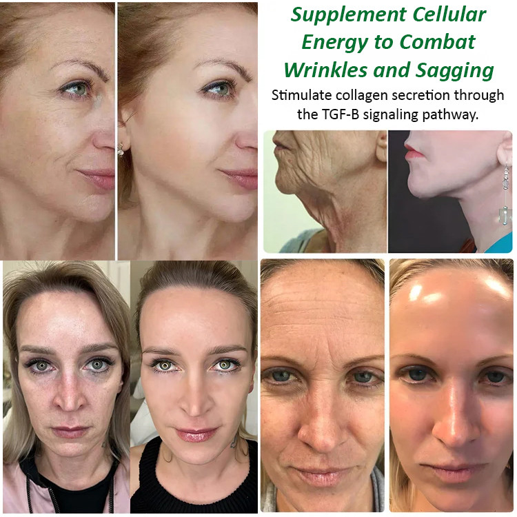 Enhancement of immunity Niacinamide Cortisol Tablets nutrient ...