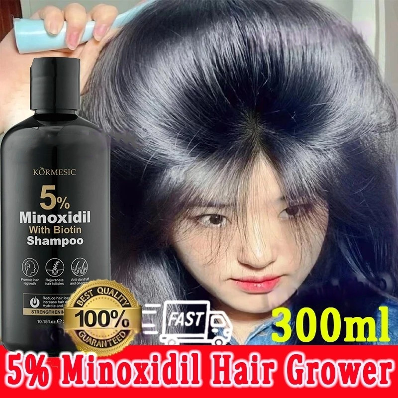 Minoxidil 5% Shampoo For Hair Loss Treatment Hair Grower Shampoo With ...