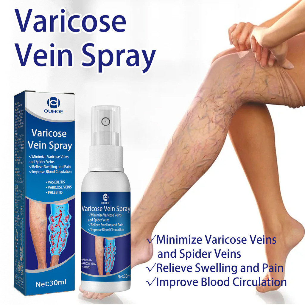 OUHOE Varicose Vein Spray 30ml Varecose Vein Ointment Varicouse ...