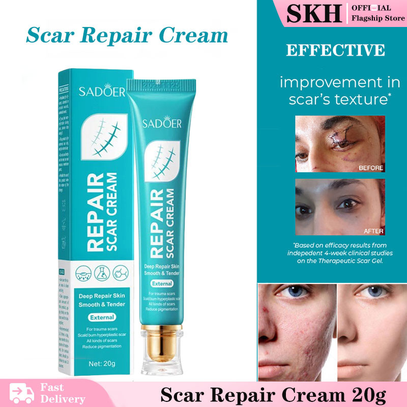 Peklat Remover Cream for Old Peklat Remove Scars Scar Remover for Old ...