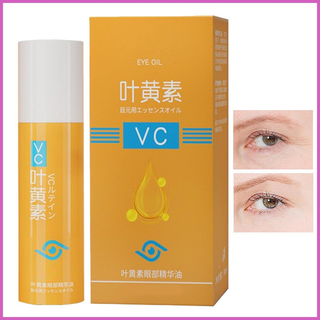 Eye Oil Tightening Eye Oil Roller 8ml Instant Firm Eye Tightener Eye ...