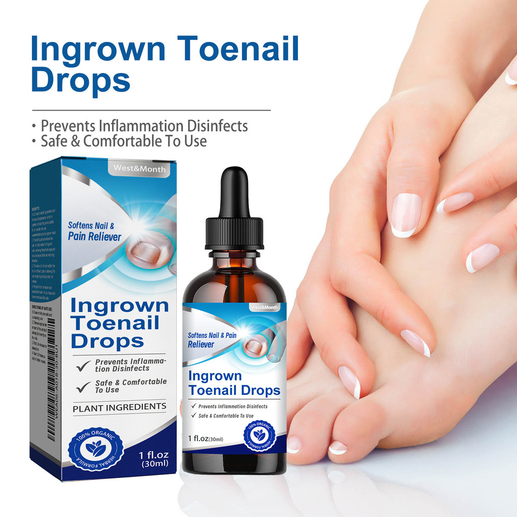 [Natural Ingrown Toenail Savior]Ingrown Toenail Drops Antiphlogosis ...