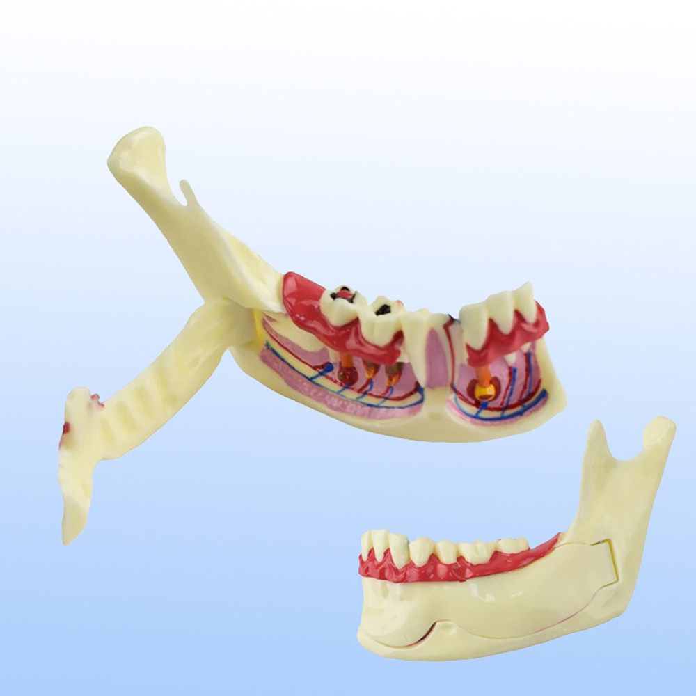 Dental Endodontic Treatment Model Mandible Tissue Anatomical Model ...
