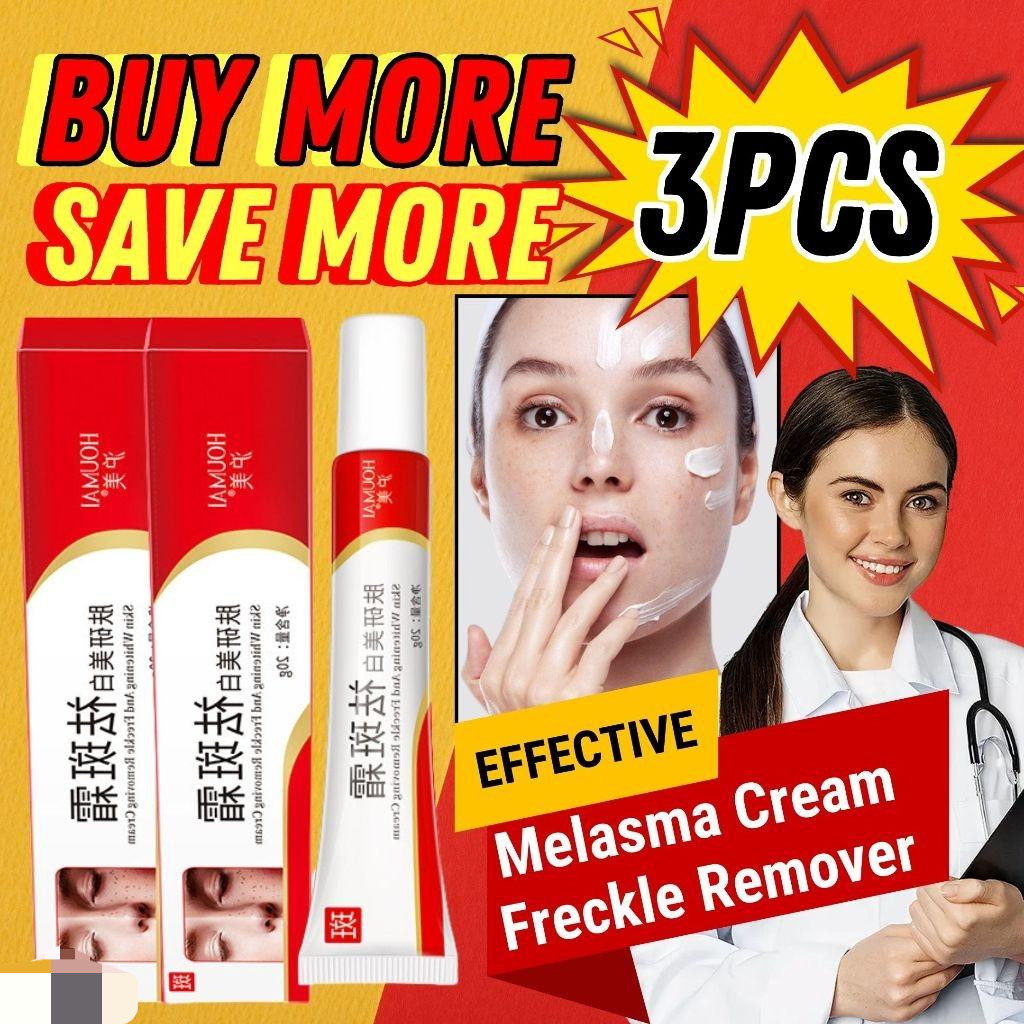 [Set Of 3pcs] Melasma Cream Pekas Collagen Japan Pekas Remover Original ...