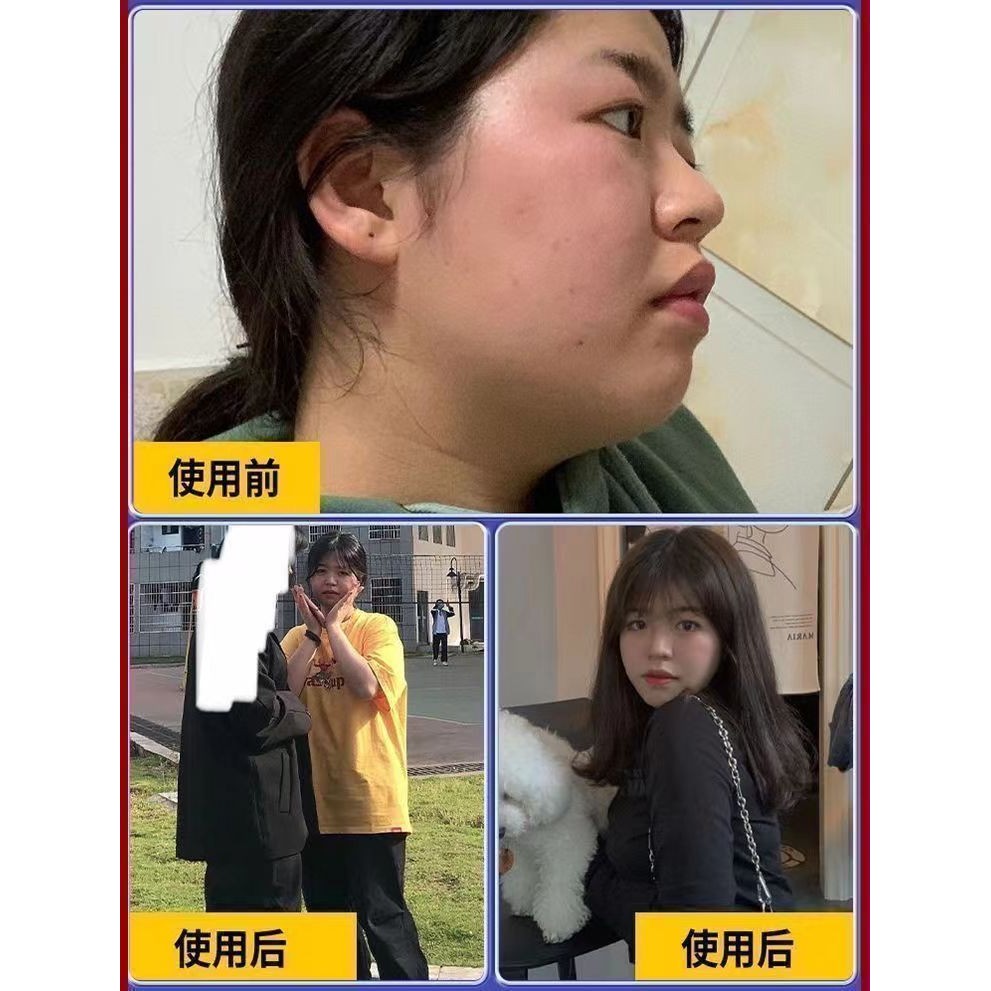 Reduce Fat slimming Weight Loss/One Capsule Fat Removal Tablets ...