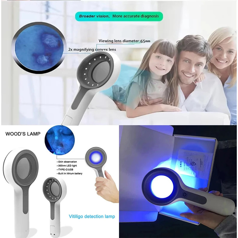 Wood's Lamp Ultraviolet Skin Analysis For Skin Examination Test Medical ...