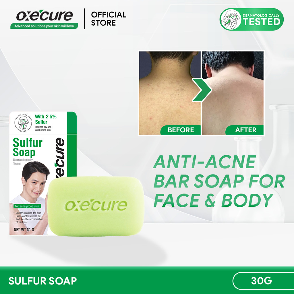 OXECURE SULFUR SOAP 30g [Face and body cleanser to fight and clear skin ...