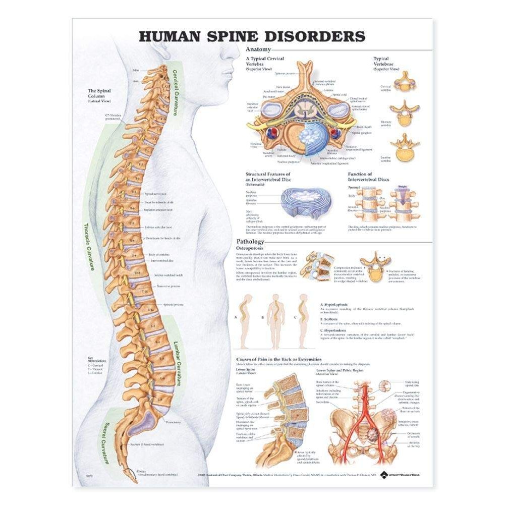 Human Spine Disorders Chart | Shopee Philippines