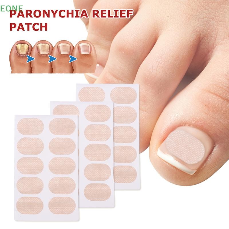 EONE 10pcs Nail Correction Stickers Ingrown Toenail Onychomycosis ...