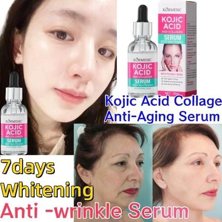 KORMESIC Kojic Acid Collagen Serum Melasma Remover Whitening ...