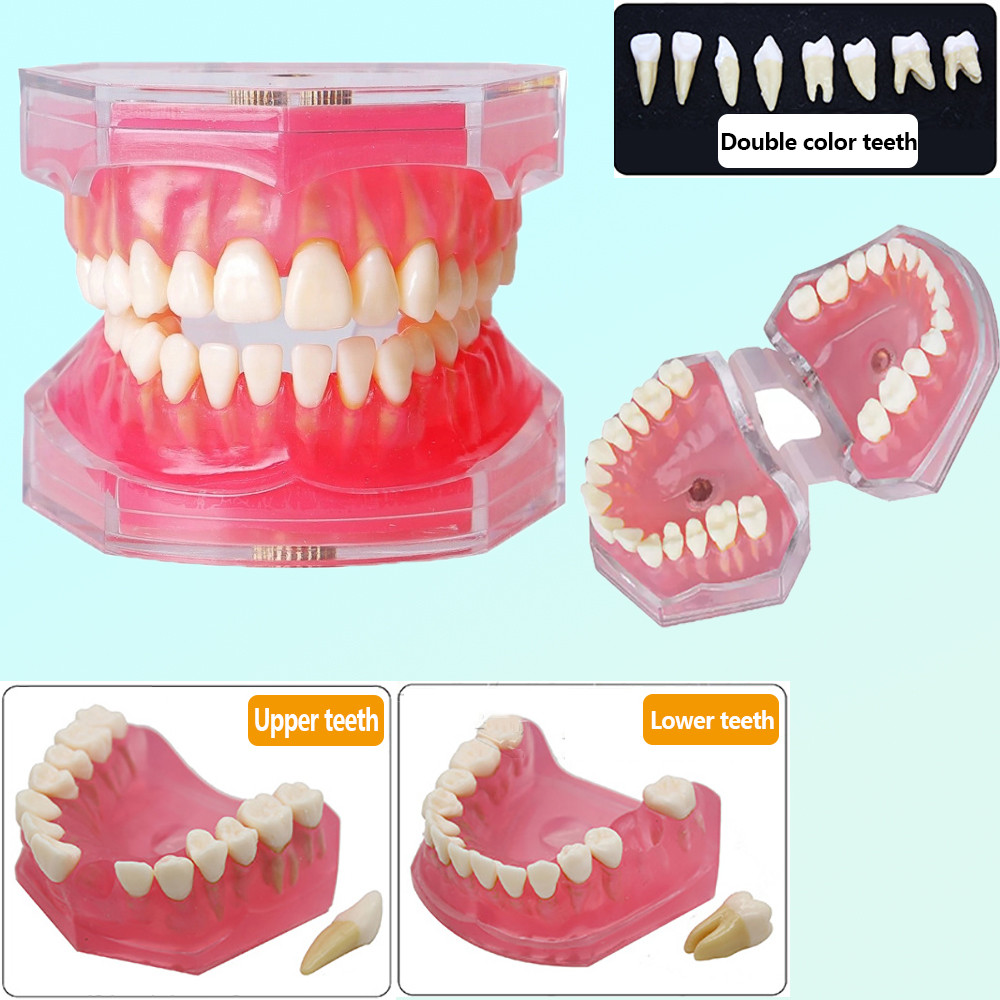Dental Teeth Model Removable teeth Dental Model With Removable Teeth ...