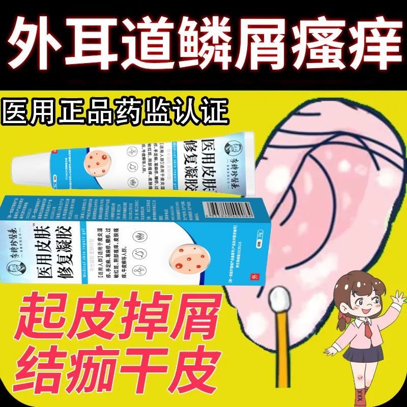 Ear Canal Dandruff, Ear Surrounding Skin Flaking, Ear Canal Skin ...