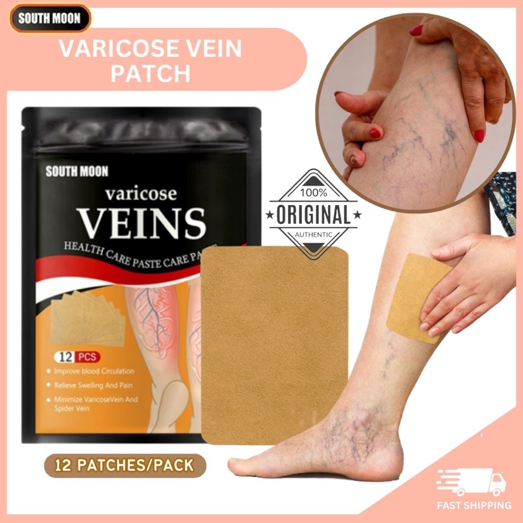 Varicose Vein Plaster Patches Smooth Bulging Blood Vessels Varicose ...