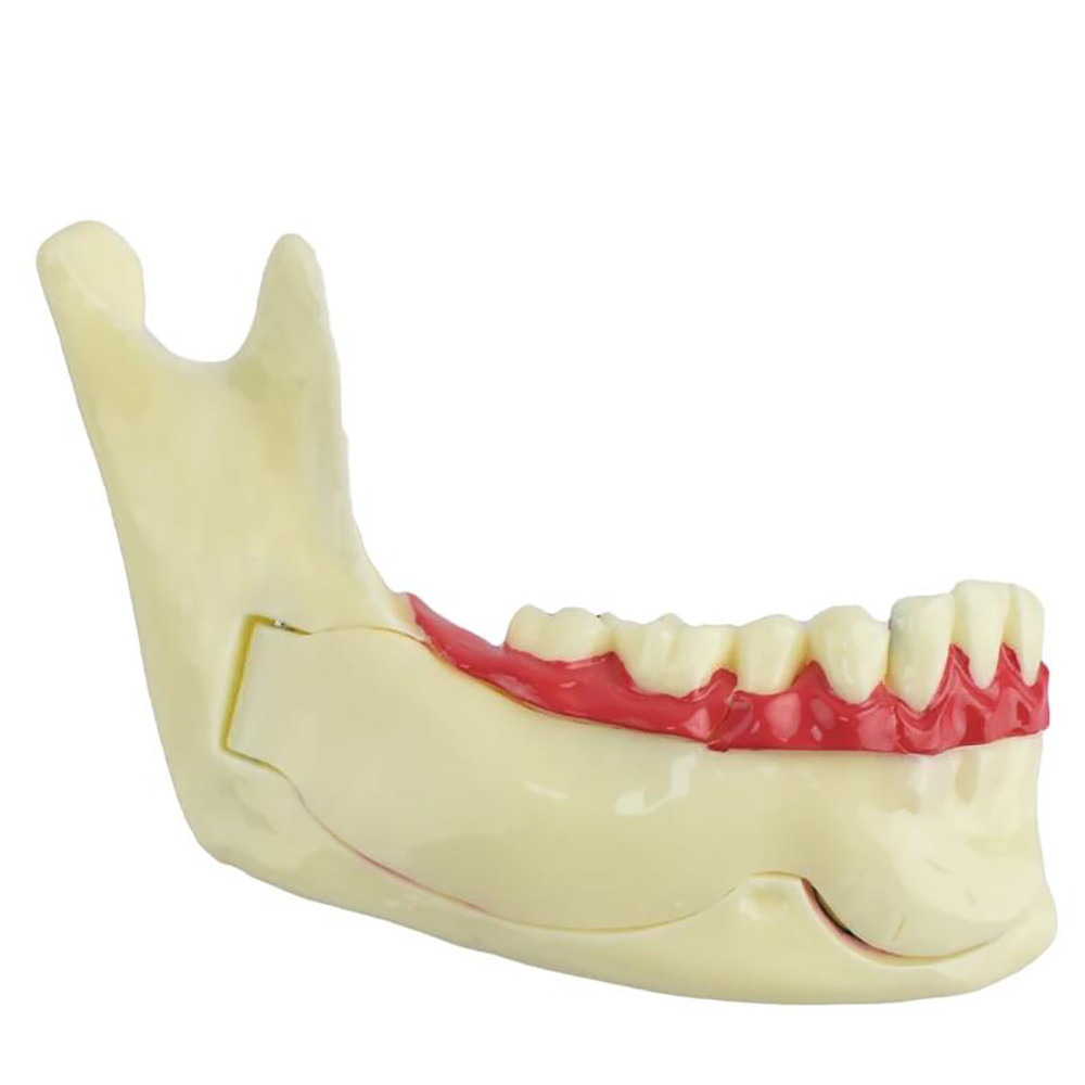 Dental Endodontic Treatment Model Mandible Tissue Anatomical Model ...