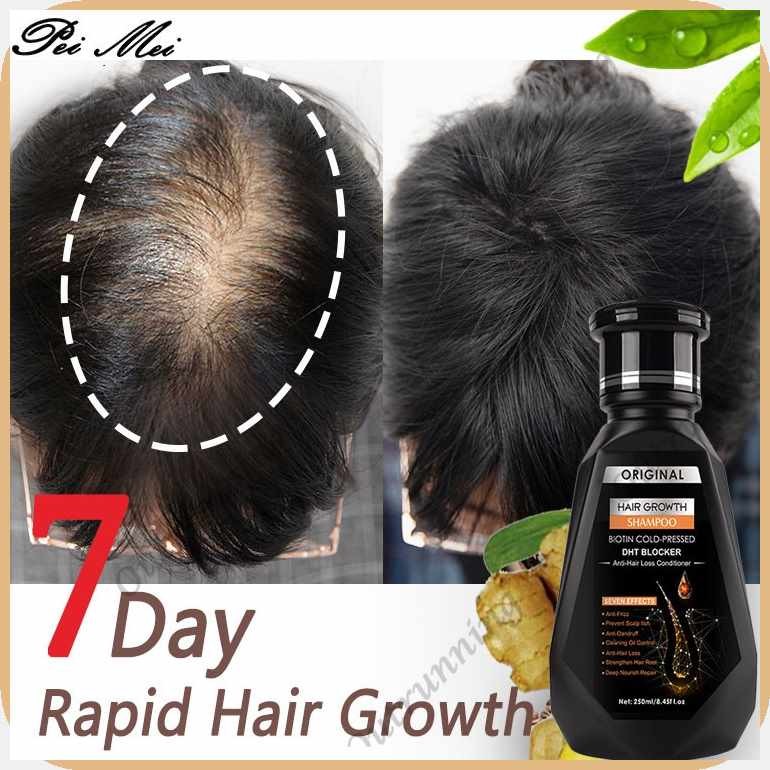 PEIMEI*V,ginger:Reshampoo