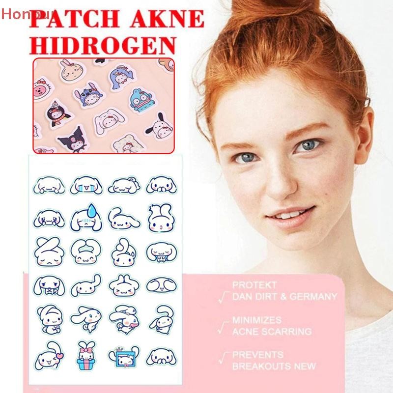 [Honour] Cartoon Sanrio Hello Kitty Acne Pimple Patch Sticker Soothing ...