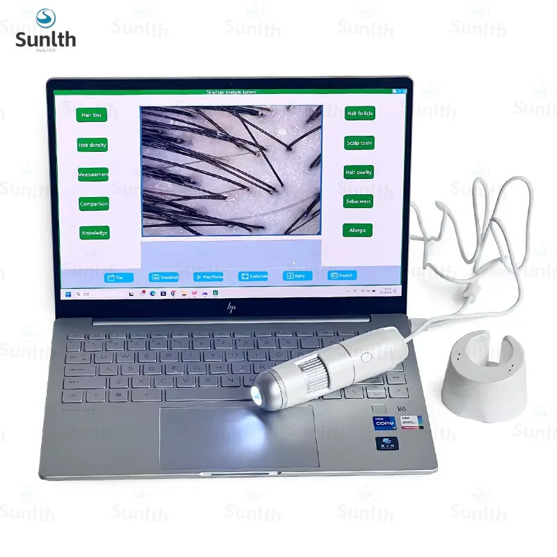 Professional Digital Microscope Electron Dermatoscope Scalp Detection ...