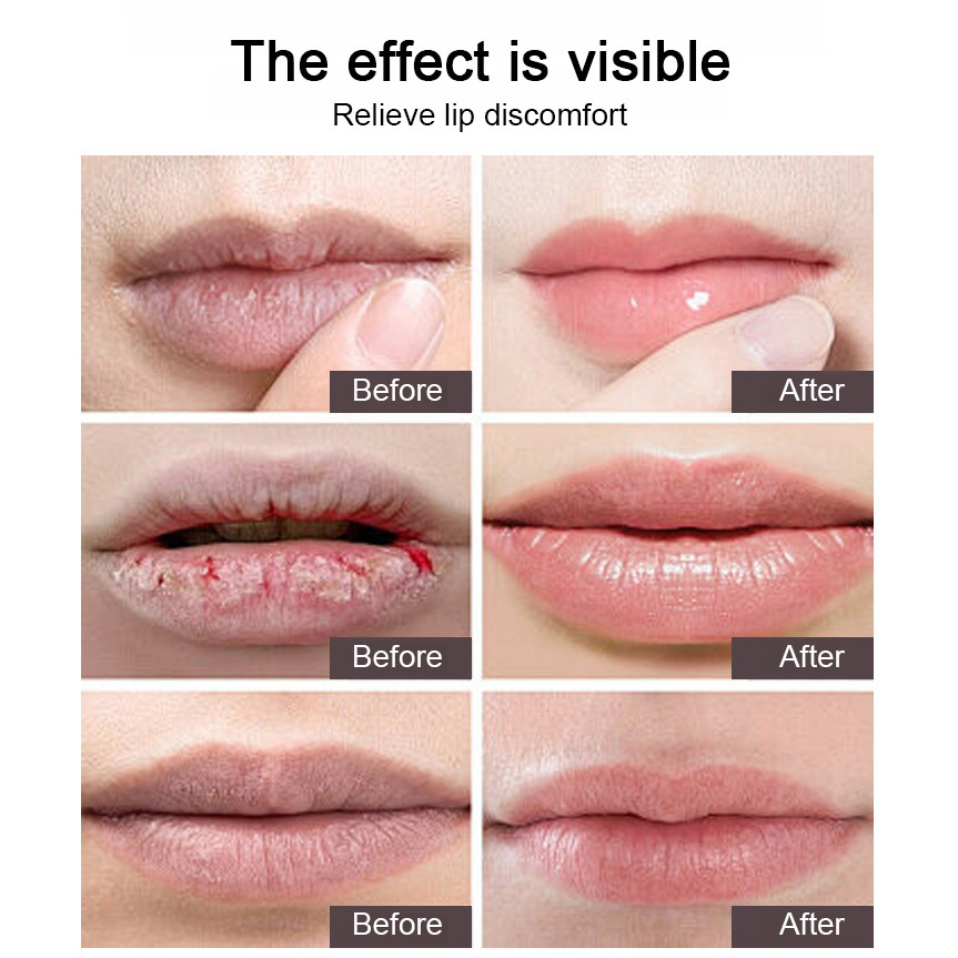 Pink Fade Lip Lines Moisturizing Gel | Shopee Philippines