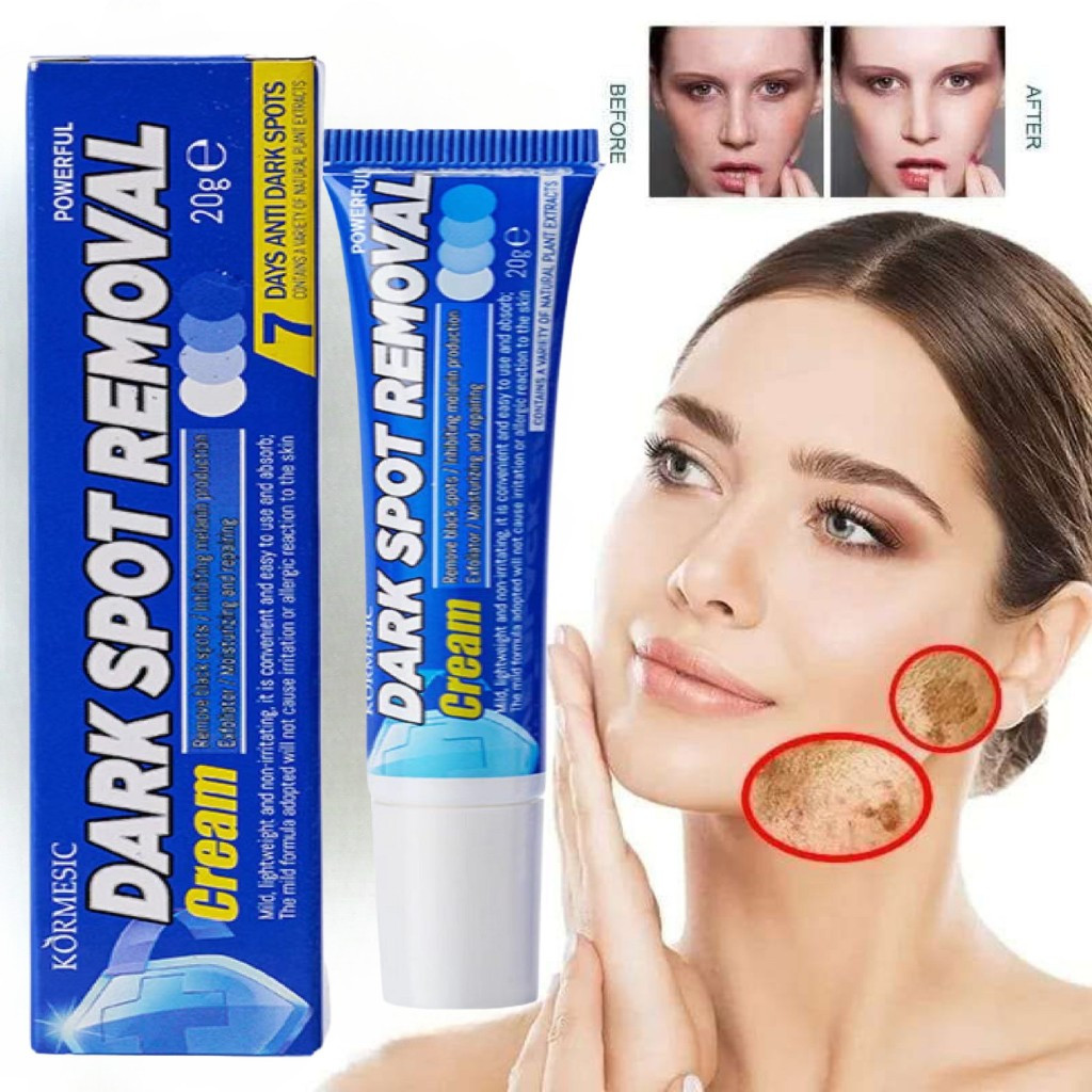 Pekas Remover Effective Melasma Cream Anti Freckle Collagen Skin ...