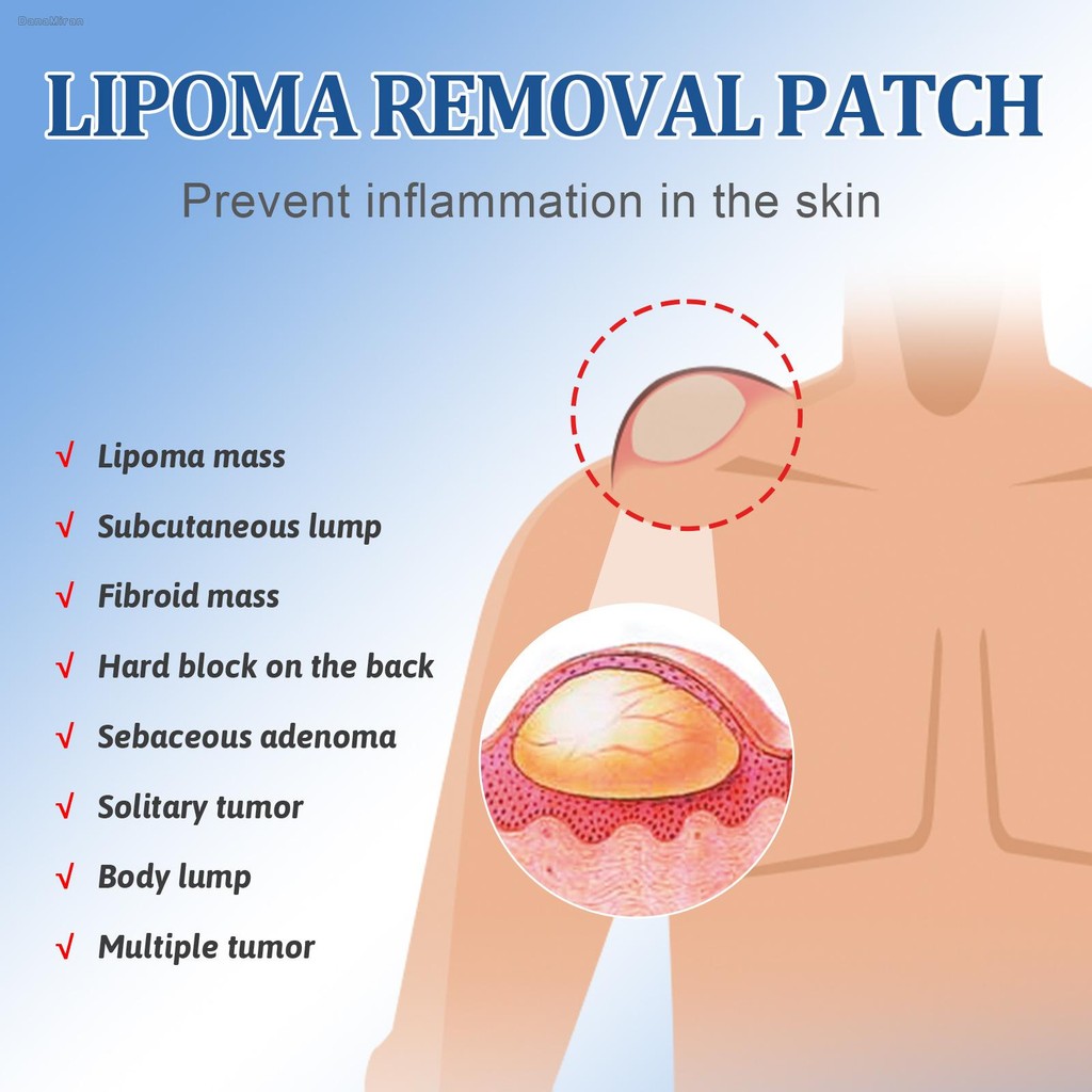 Lipoma Removal Patch Herbal Composition Subcutaneous Mass Care Patch ...