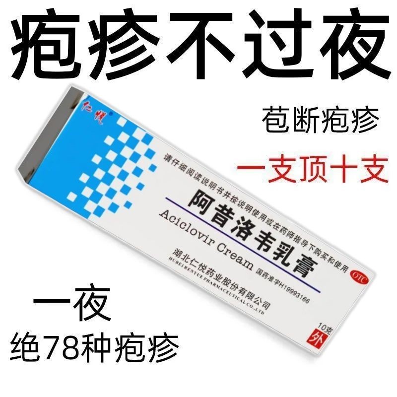 Renyue Acyclovir Cream 10g*1Support/Box Shingles Residue Neuralgia ...