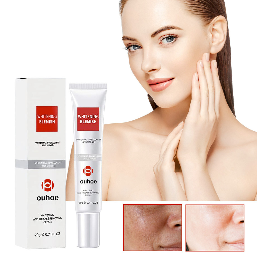 OUHOE Freckle Removal Cream 20g Whitening Anti Melasma Removal Dark ...