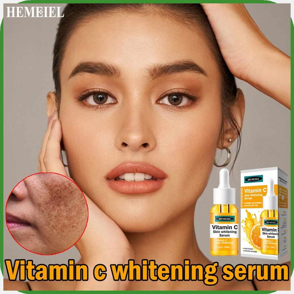 HEMEIELE:Vitamin&Fz.C>pL)Serum/Niacinamide/Melasma}hy)Cream}UE)Pekas}MZ ...